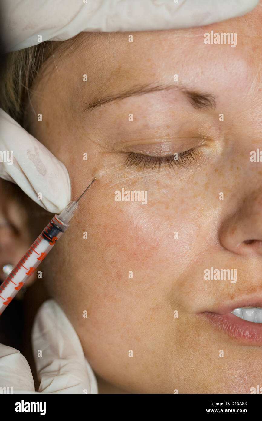 Botox injection in the eye corner, close up Stock Photo - Alamy