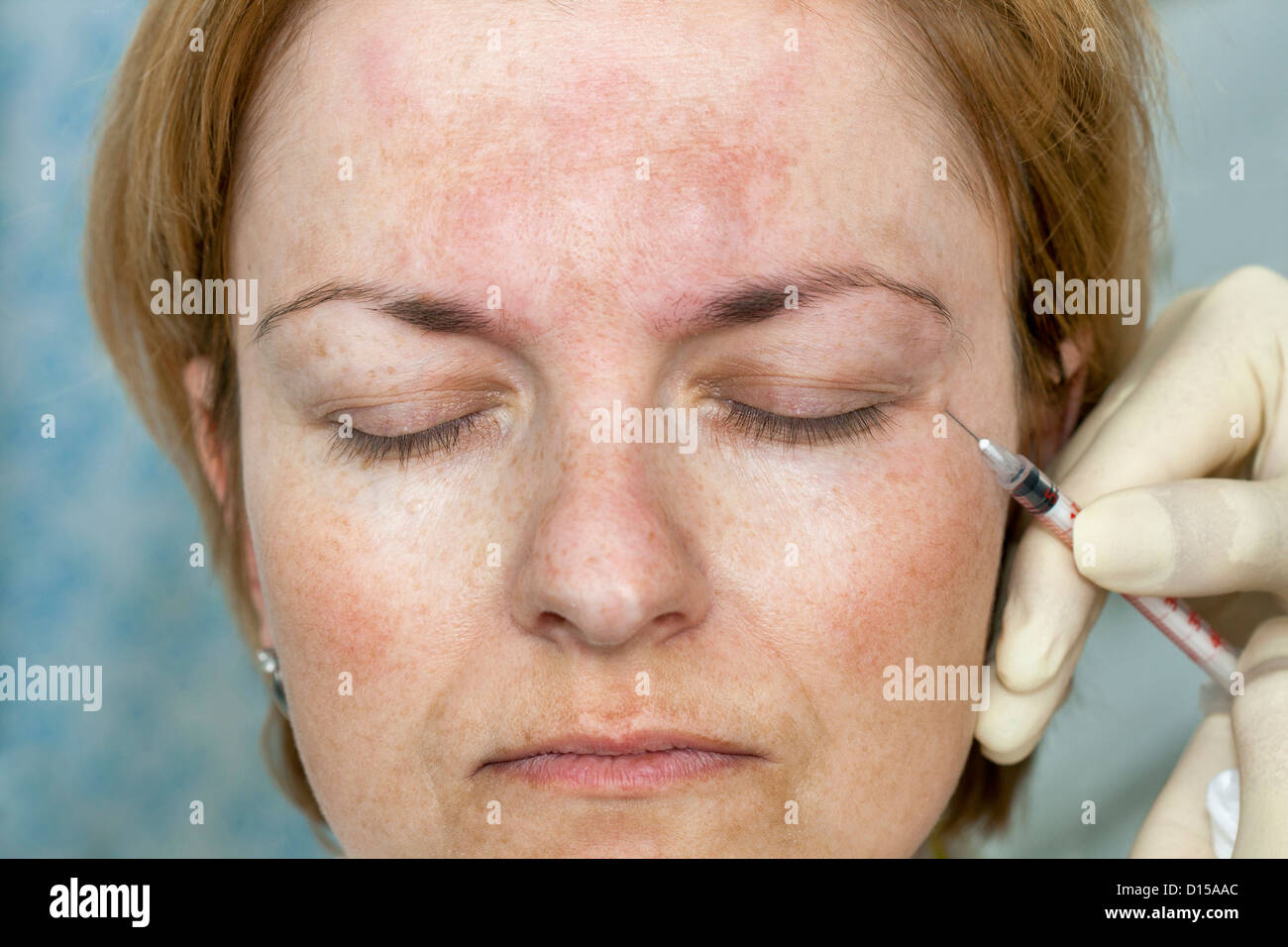 Botox injection in the eye, close up Stock Photo - Alamy