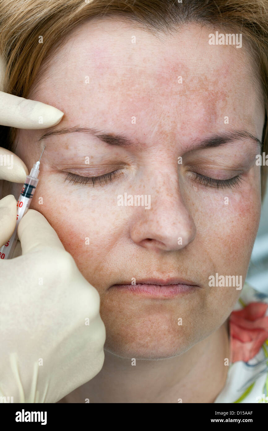 Botox injection in the superciliary area, close up Stock Photo - Alamy