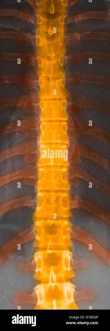 Human Spine Normal High Resolution Stock Photography and Images - Alamy