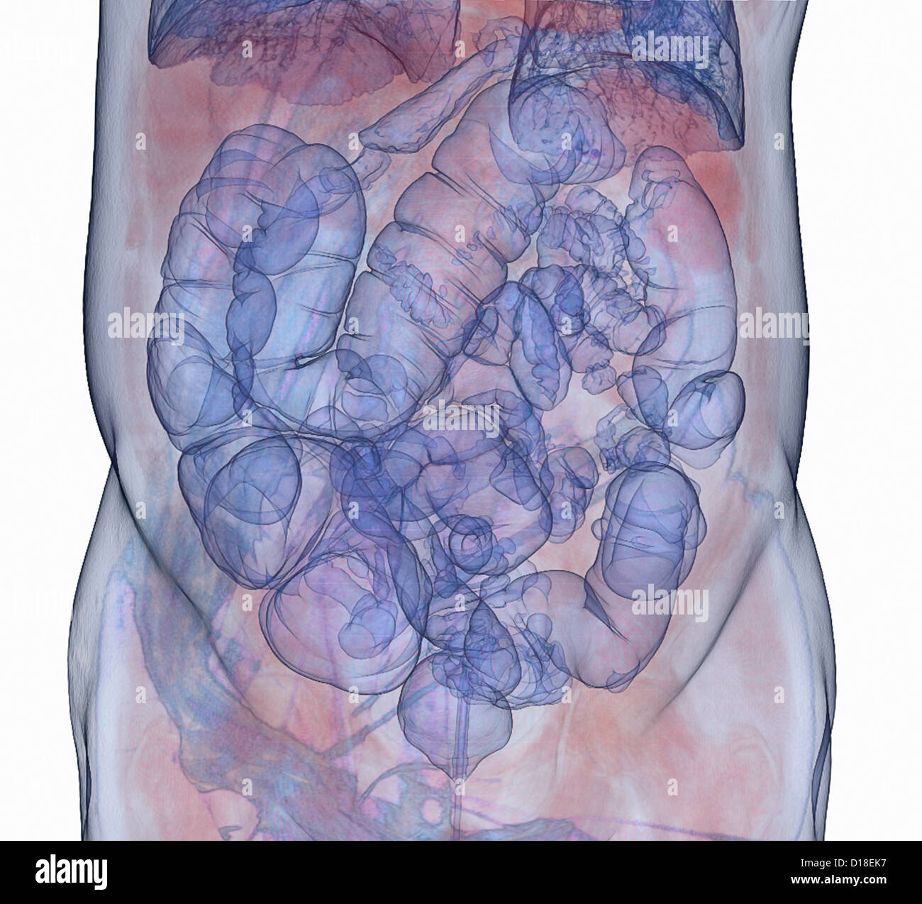 Colonoscopy us hi-res stock photography and images - Alamy