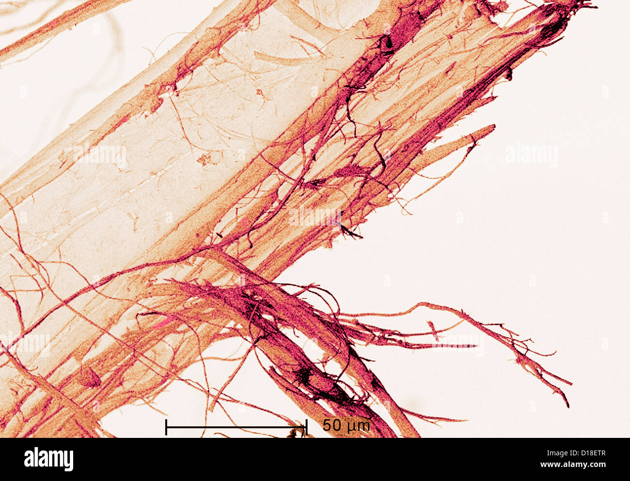 Scanning Electron micrograph of asbestos Stock Photo - Alamy