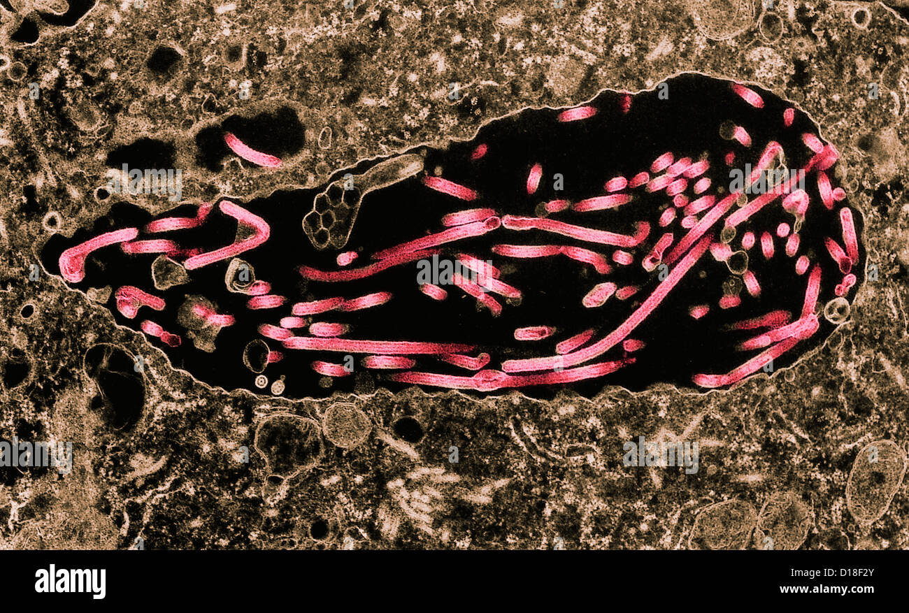 Transmission Electron micrograph of Ebola virus Stock Photo - Alamy