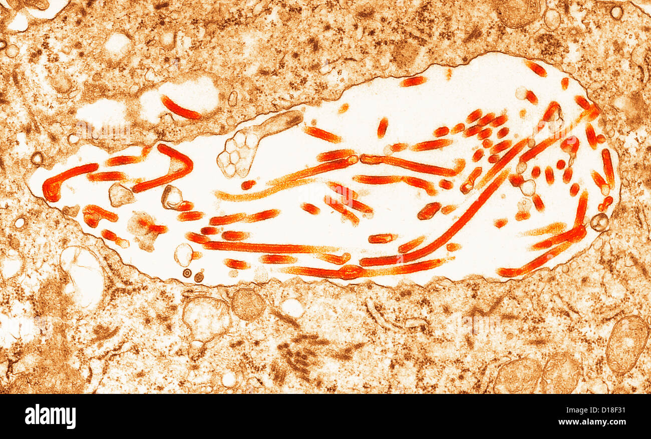 Transmission Electron micrograph of Ebola virus Stock Photo - Alamy