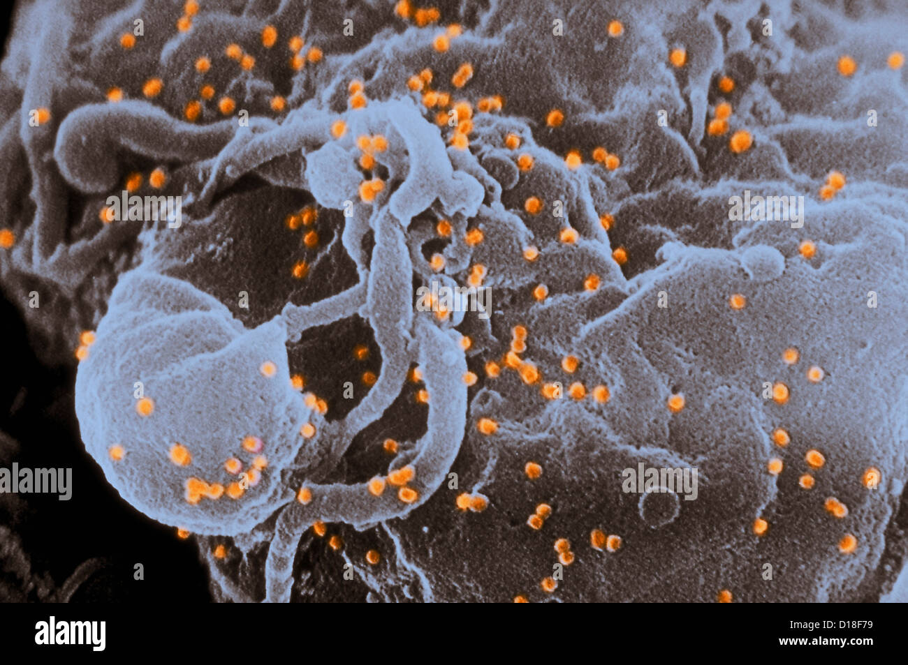 Scanning Electron micrograph of budding HIV virus Stock Photo - Alamy