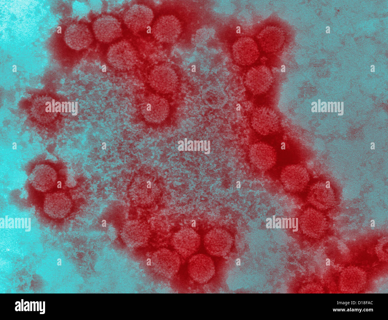Electron micrograph of canine adenovirus Stock Photo - Alamy