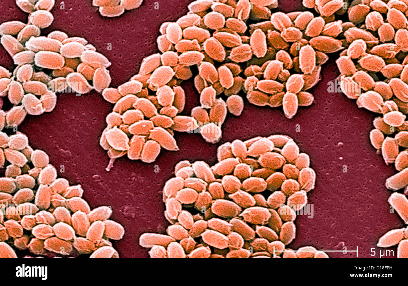 Bacillus anthracis micrograph hi-res stock photography and images - Alamy