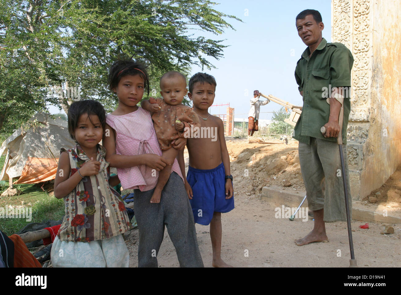 Limbless girl hi-res stock photography and images - Alamy