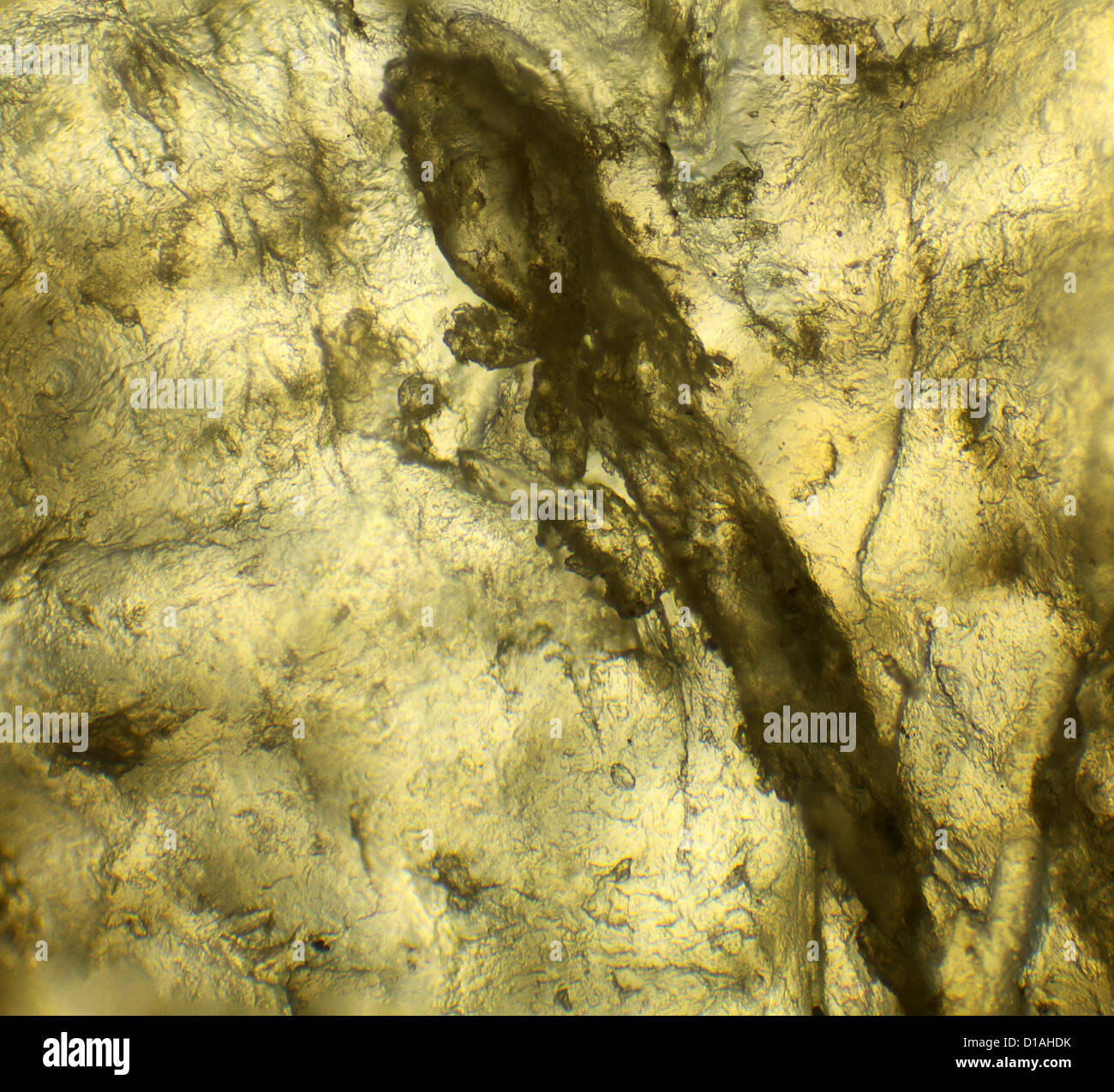 Skin under the microscope, background Stock Photo - Alamy