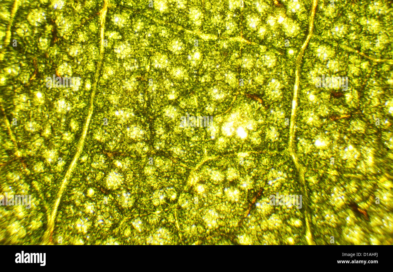 Hibiscus needles under the microscope, background. (Hibiscus Stock ...