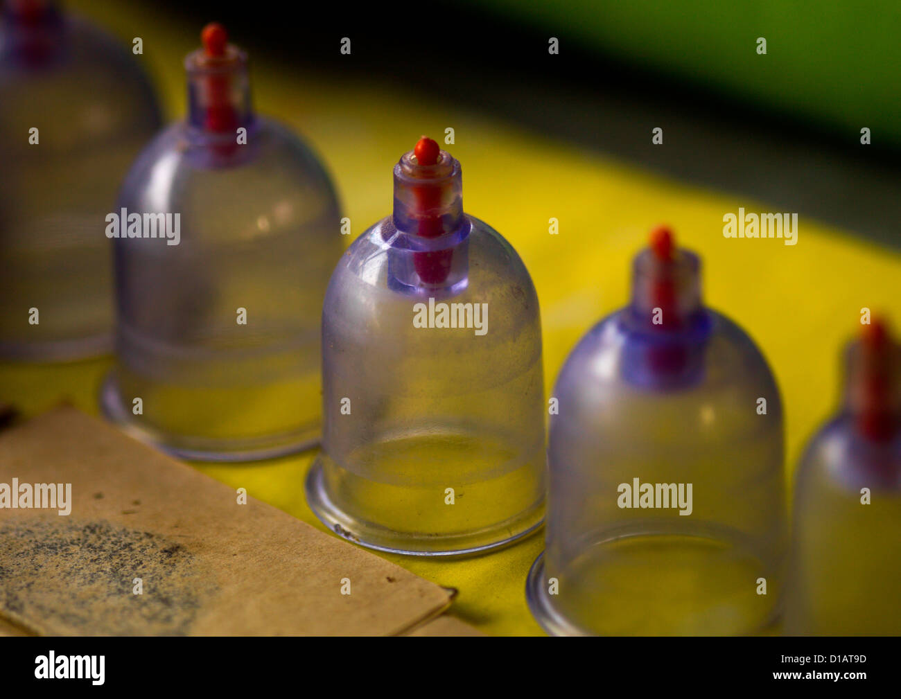 Vacuum Cupping, Menglun, Yunnan Province, China Stock Photo - Alamy