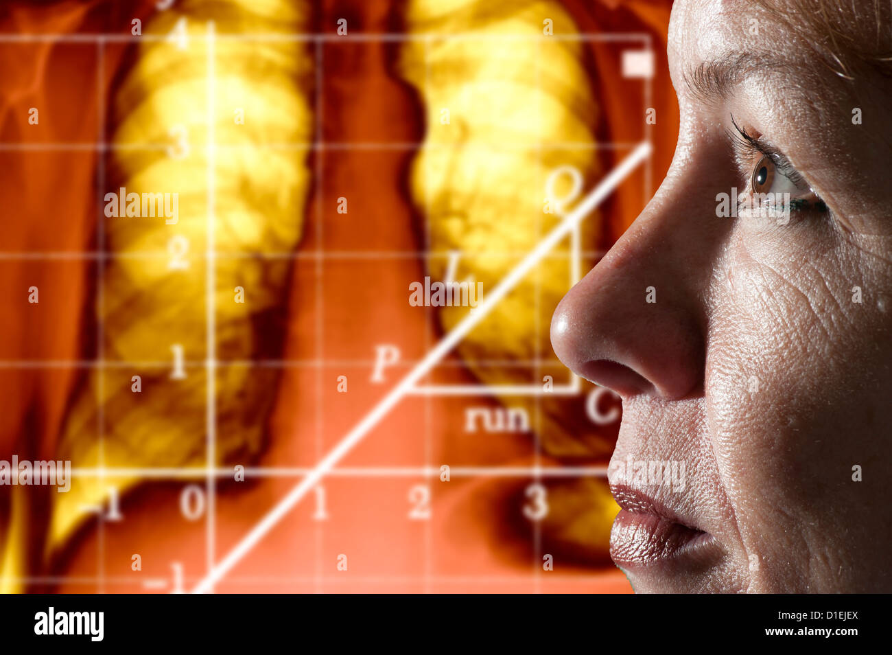 Chest x ray hi-res stock photography and images - Alamy