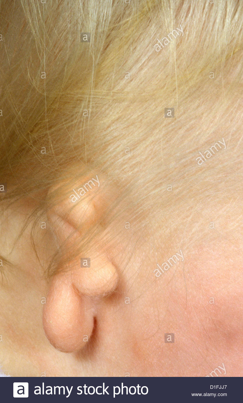 Aural Stock Photos & Aural Stock Images - Alamy