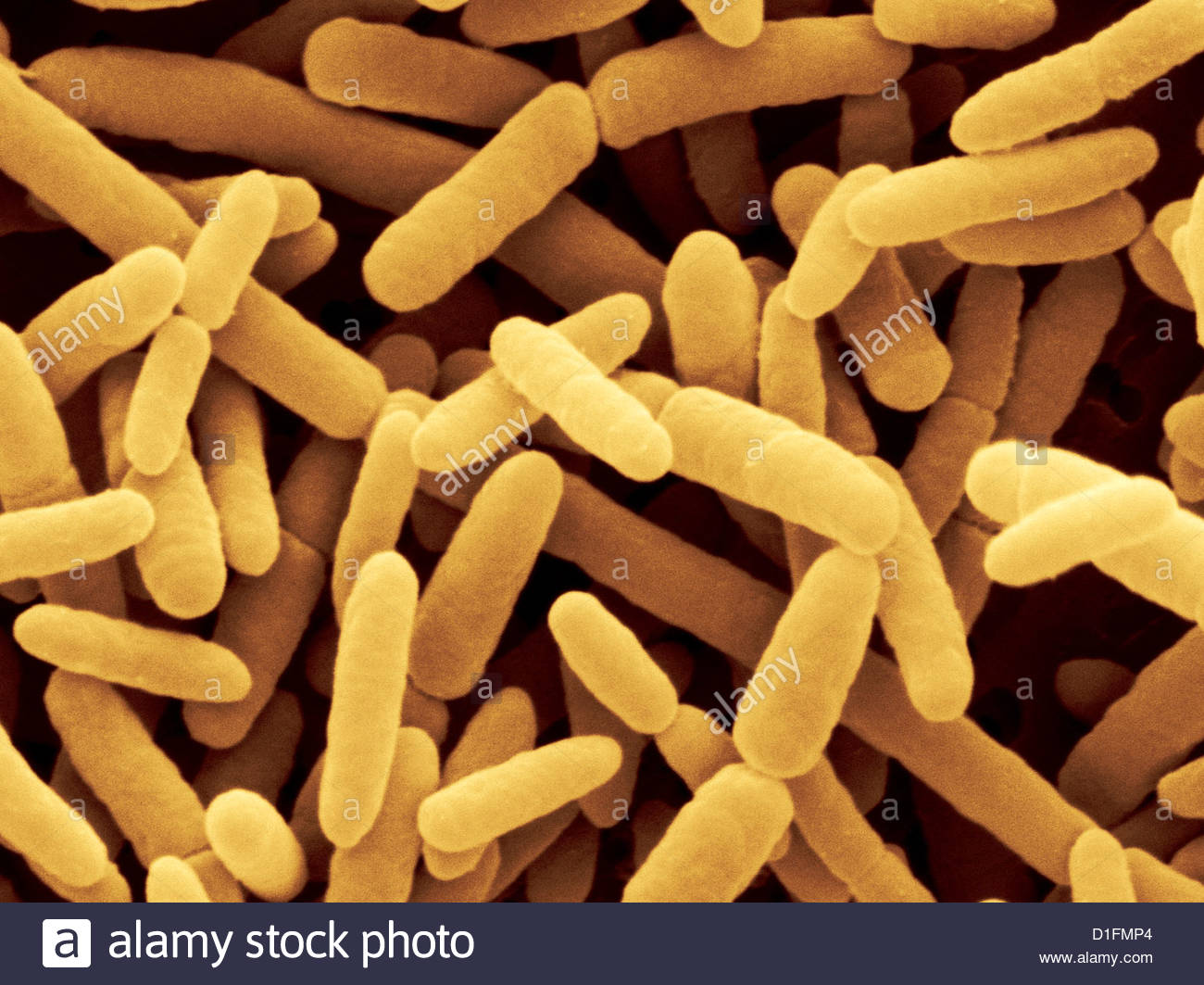 Coliform Bacteria Stock Photos & Coliform Bacteria Stock Images - Alamy