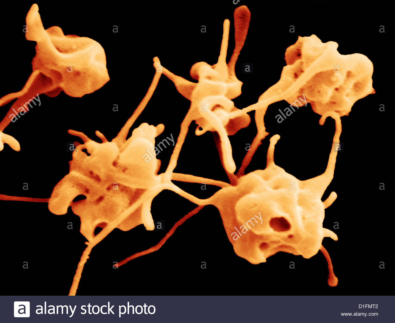 Blood Clot Sem Stock Photos & Blood Clot Sem Stock Images - Alamy