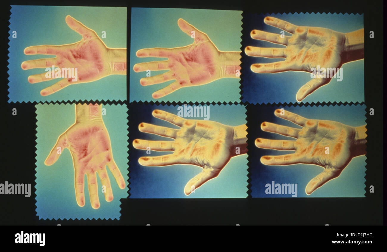 Alien Hand -- Szenenbild TLC Stock Photo - Alamy