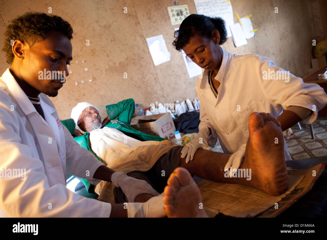 A patient receives treatment for podoconiosis (elephantiasis) at Hidase ...