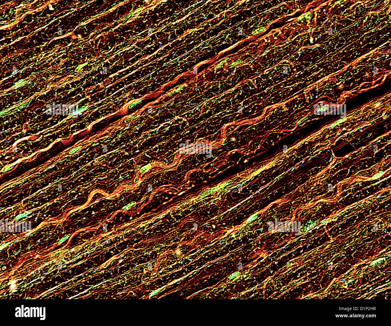 Nervous tissue micrograph hi-res stock photography and images - Alamy