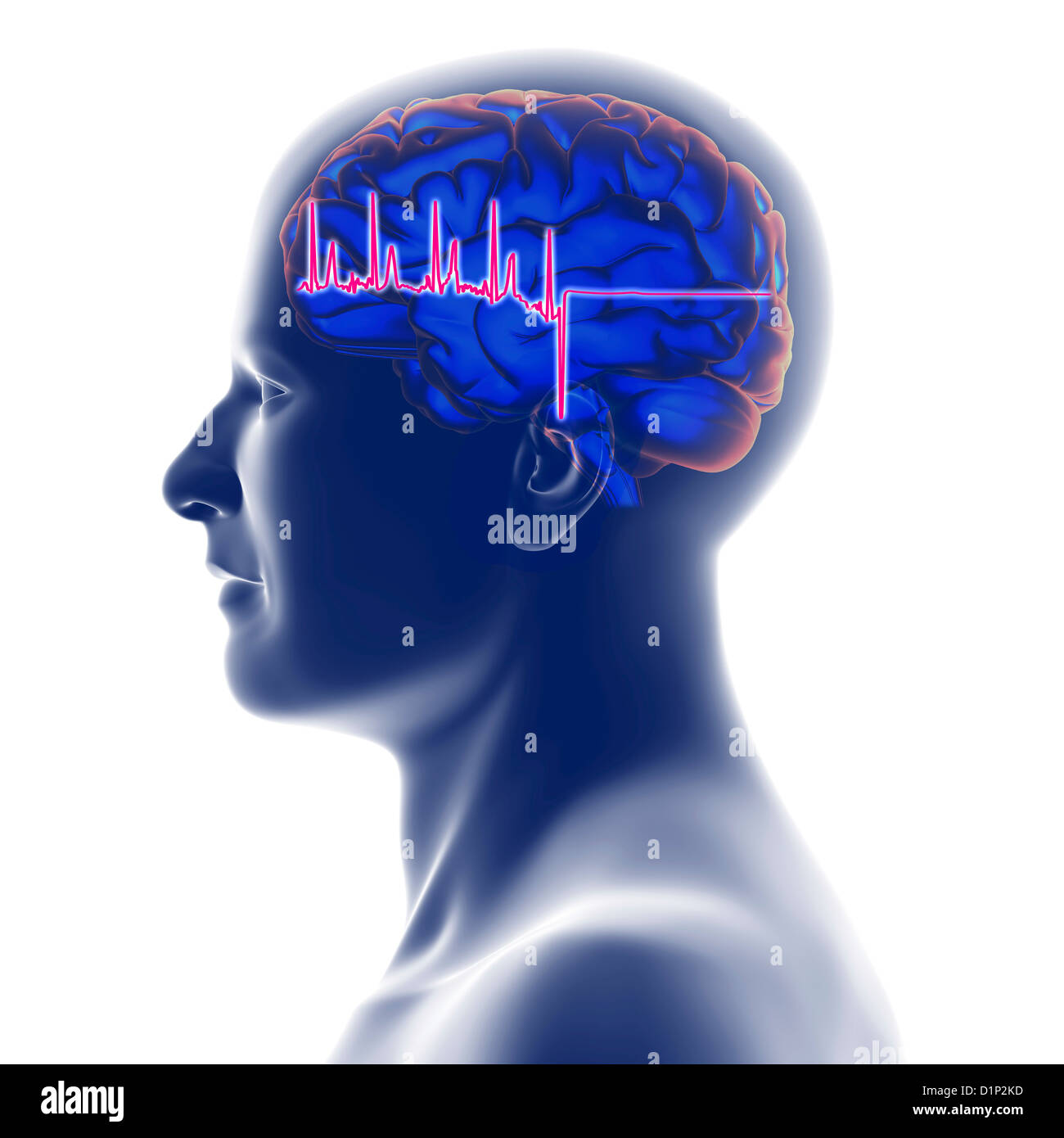 Ecg trace and mri brain scan hi-res stock photography and images - Alamy