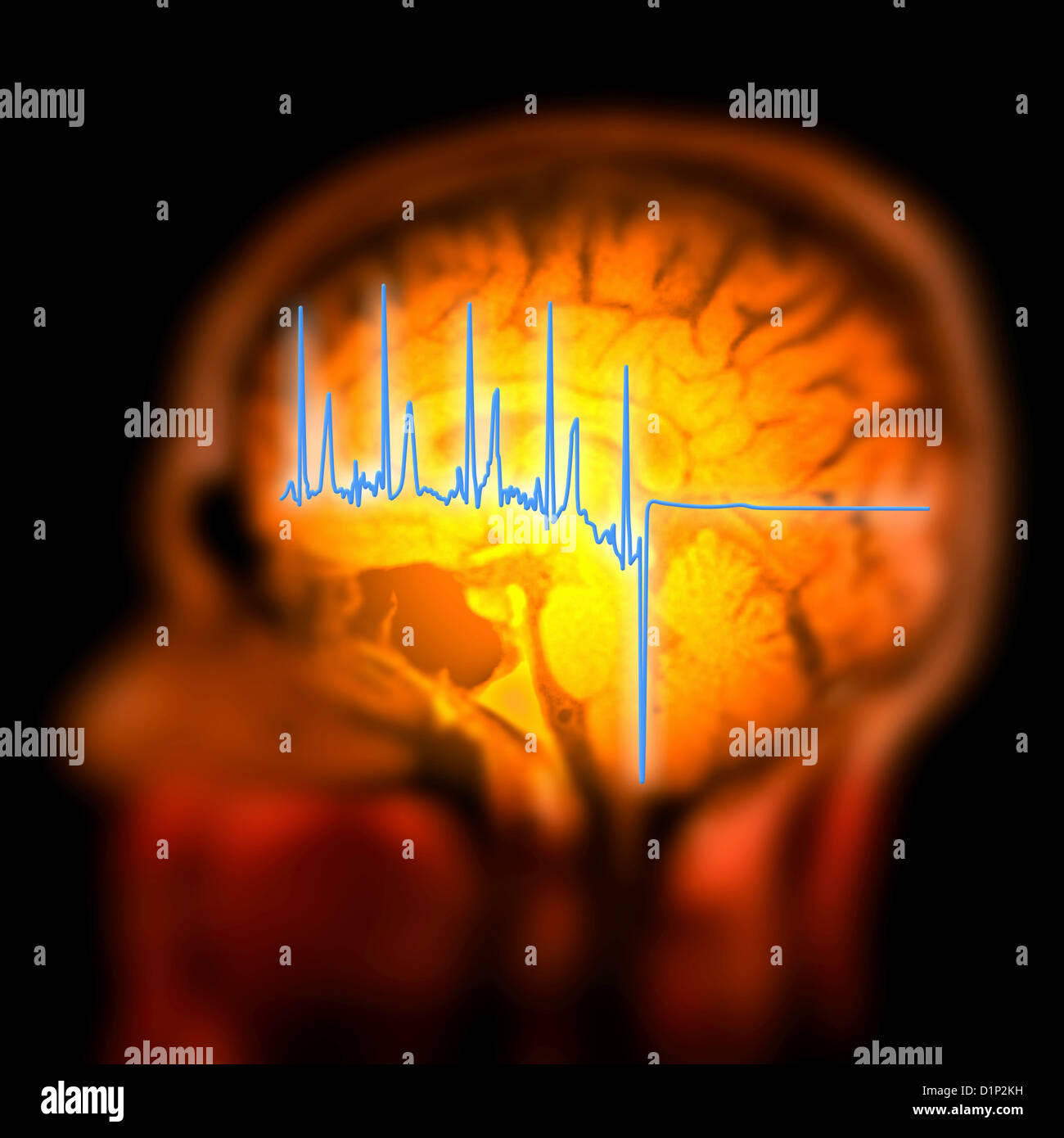 ECG trace and mri brain scan, artwork Stock Photo - Alamy