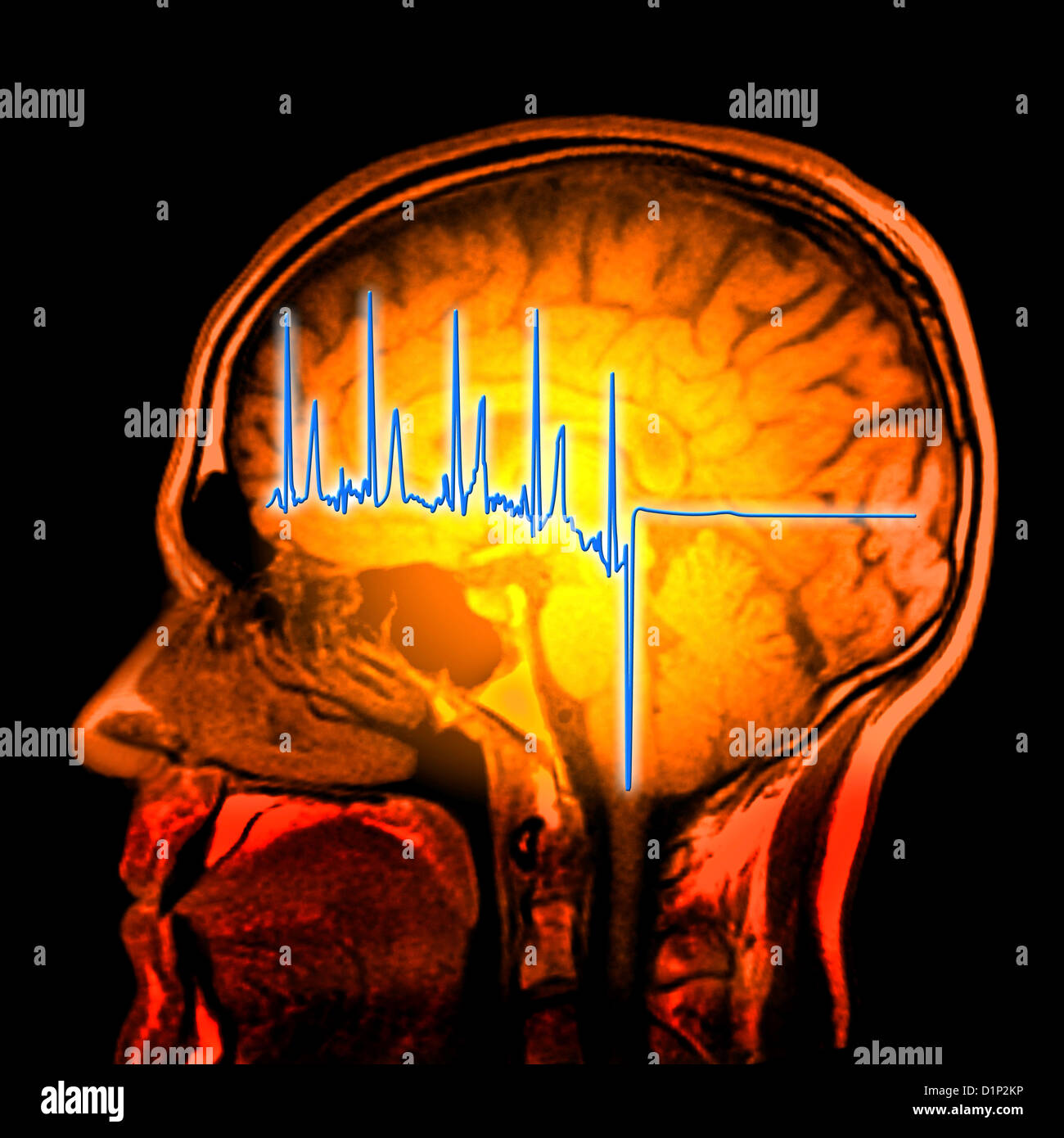 Ecg scan hi-res stock photography and images - Alamy