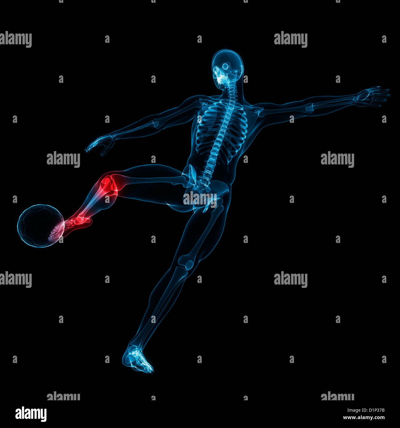 Football injury, artwork Stock Photo - Alamy