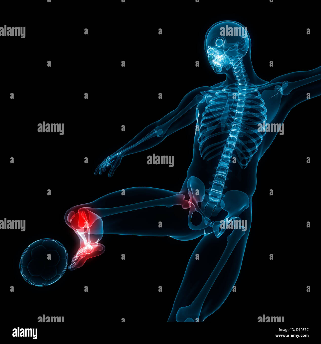Football injury artwork hi-res stock photography and images - Alamy