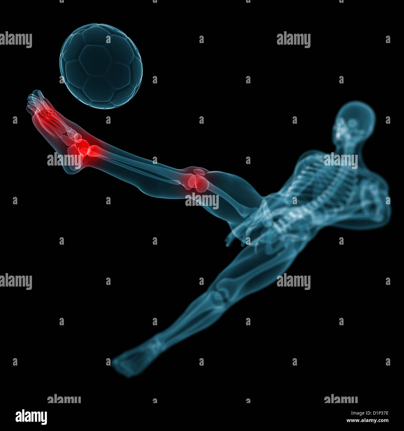 Football injury, artwork Stock Photo - Alamy