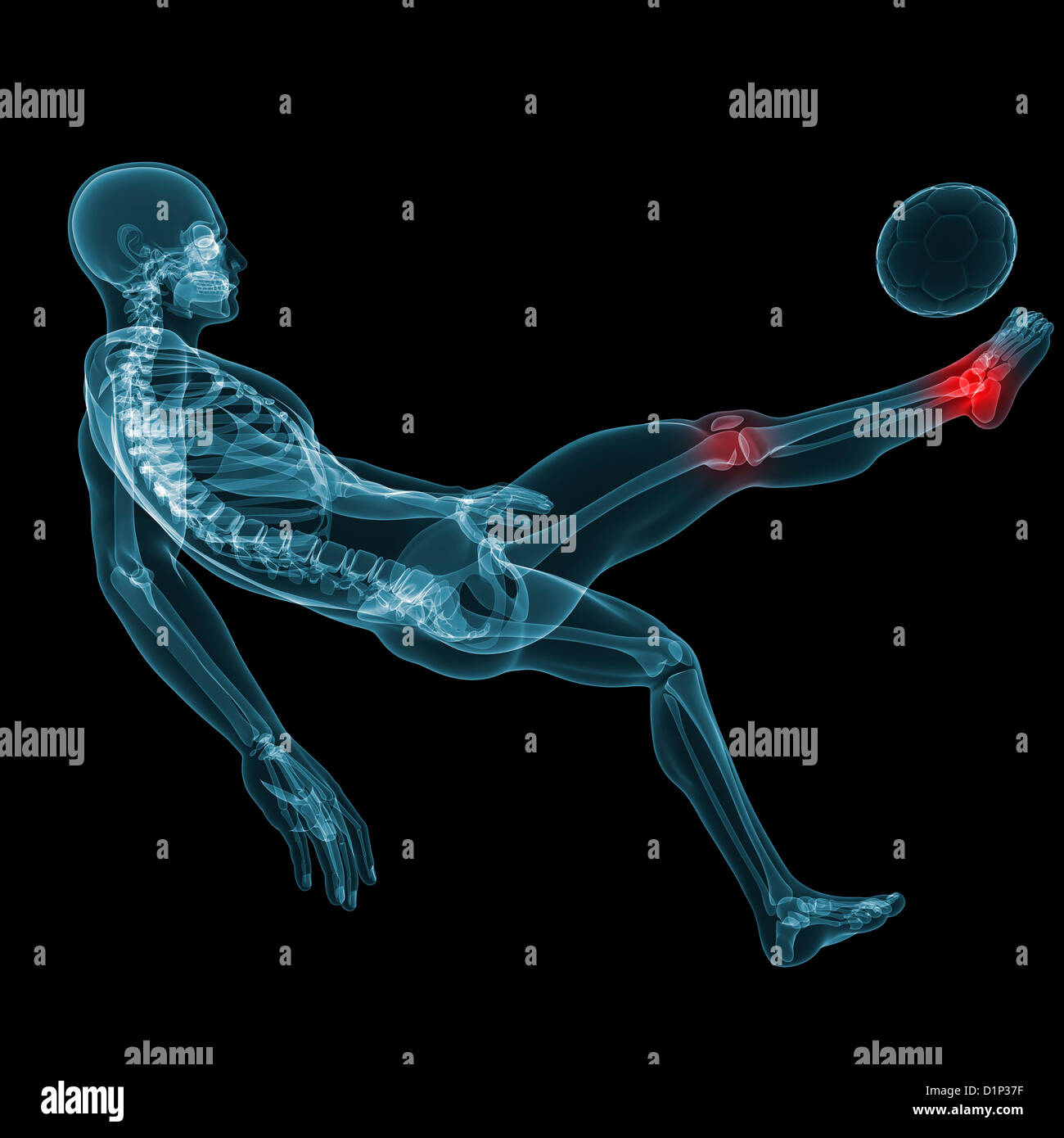 Football injury artwork hi-res stock photography and images - Alamy