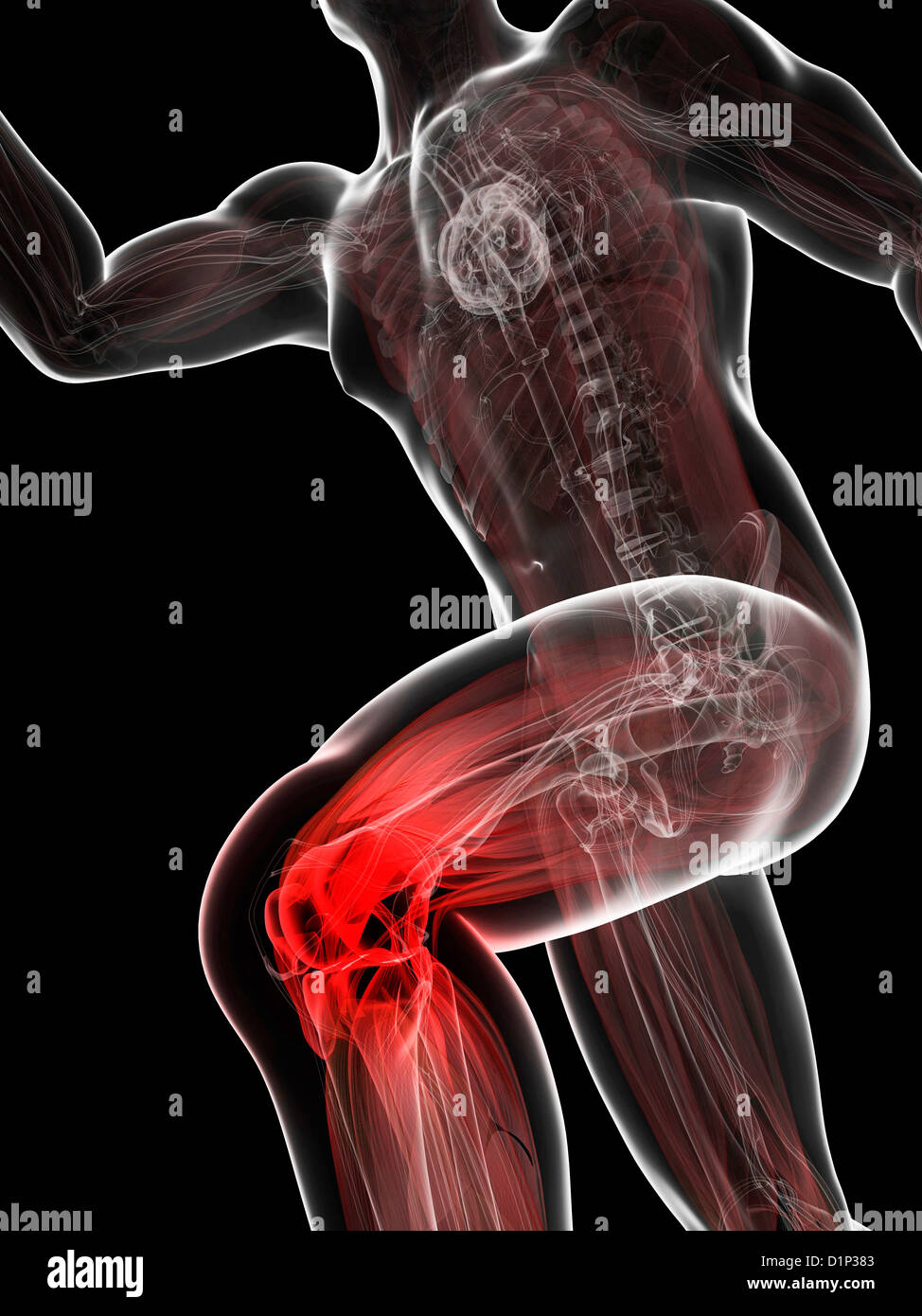 Running injury, conceptual artwork Stock Photo - Alamy