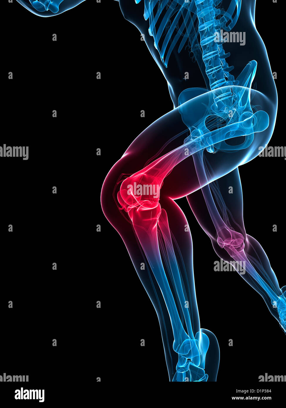 Running injury, conceptual artwork Stock Photo - Alamy