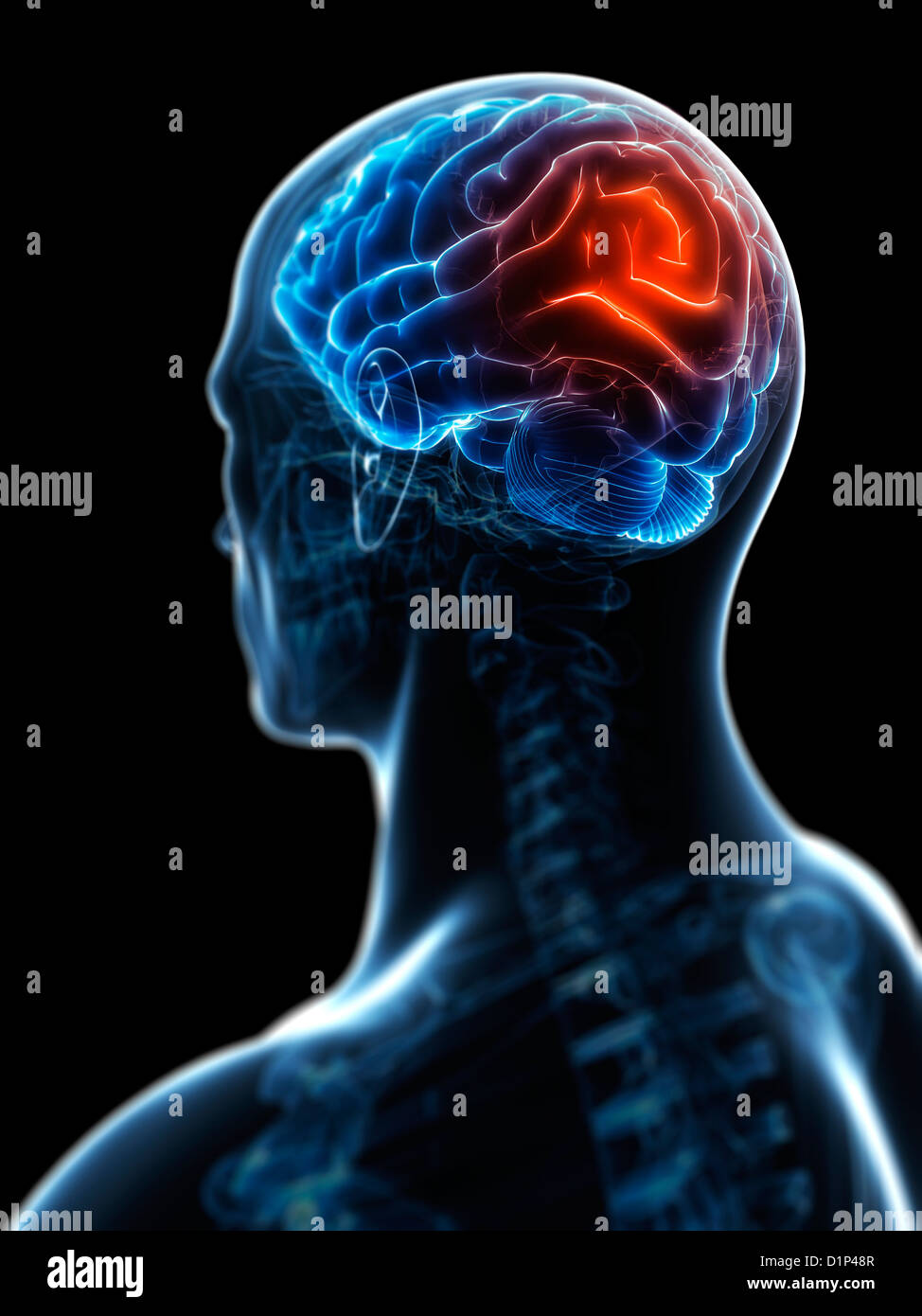 Headache representation hi-res stock photography and images - Alamy
