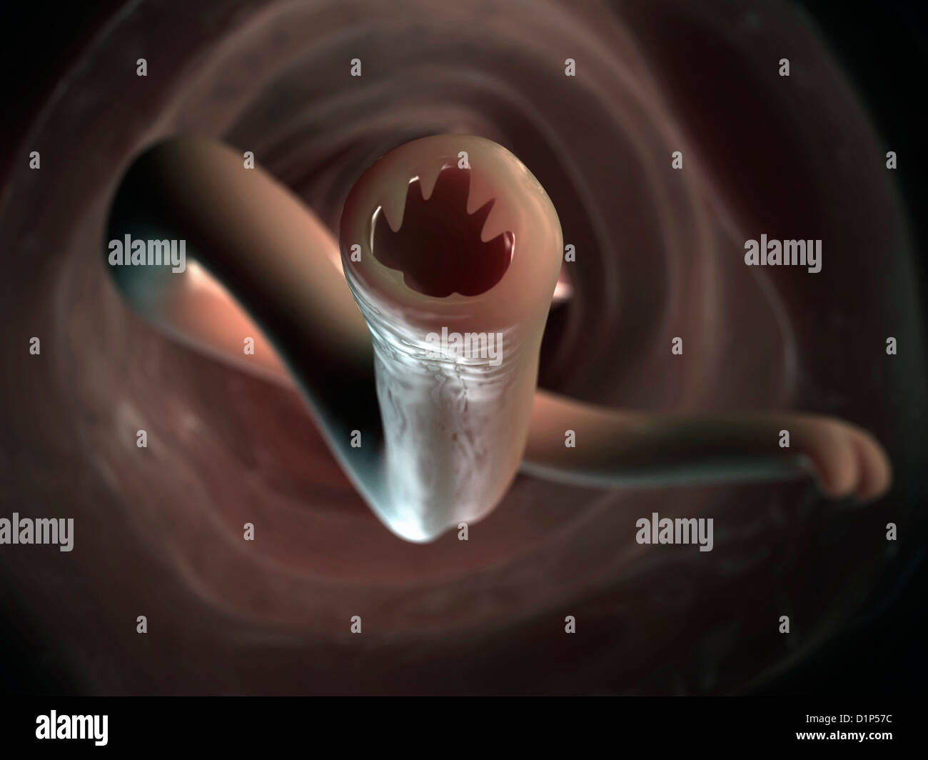 Hookworm hi-res stock photography and images - Alamy