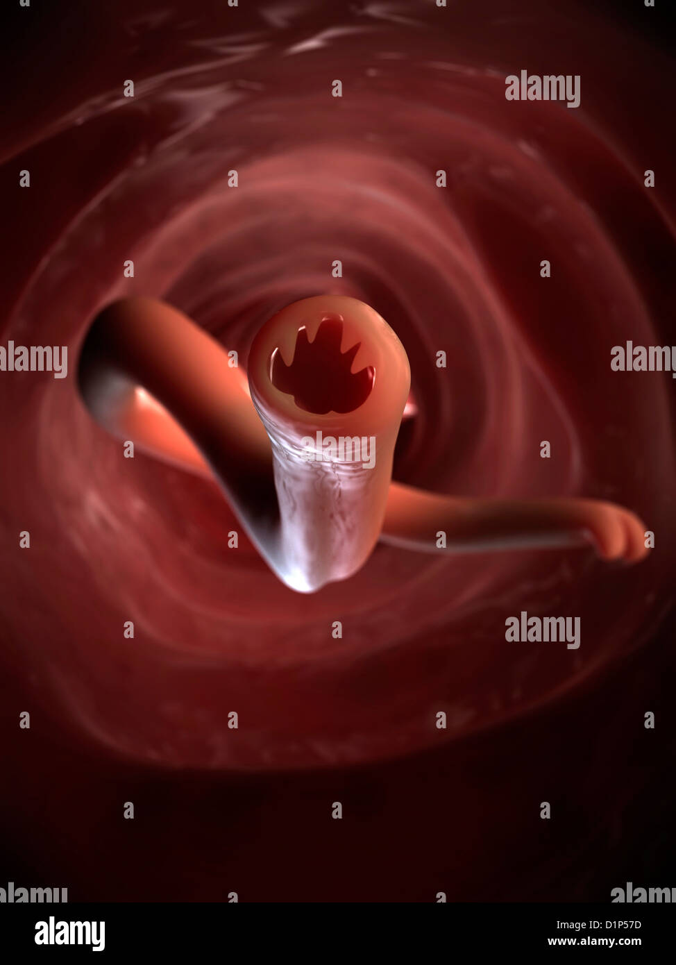 Hookworm head hi-res stock photography and images - Alamy