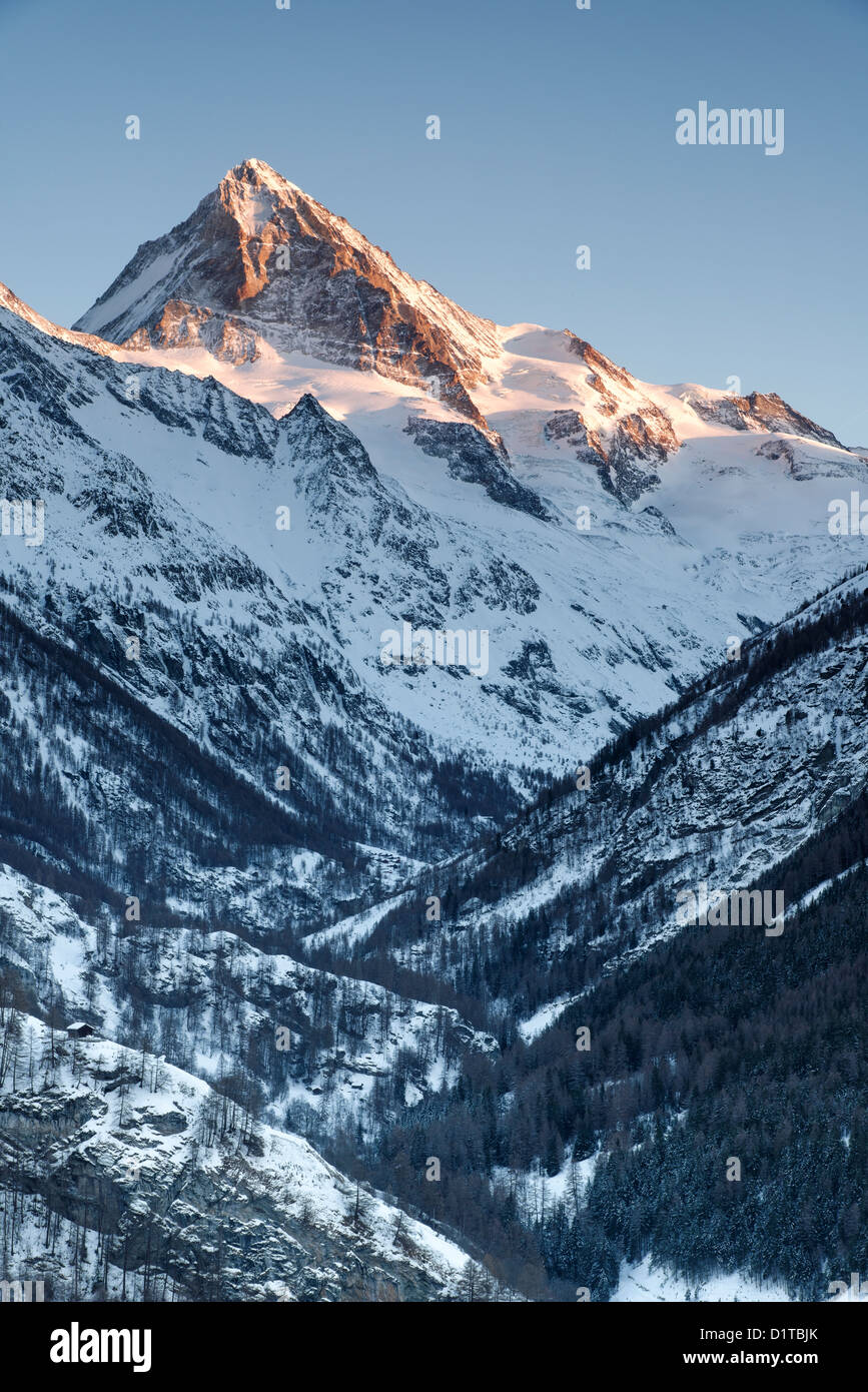 Dent blanche hi-res stock photography and images - Alamy