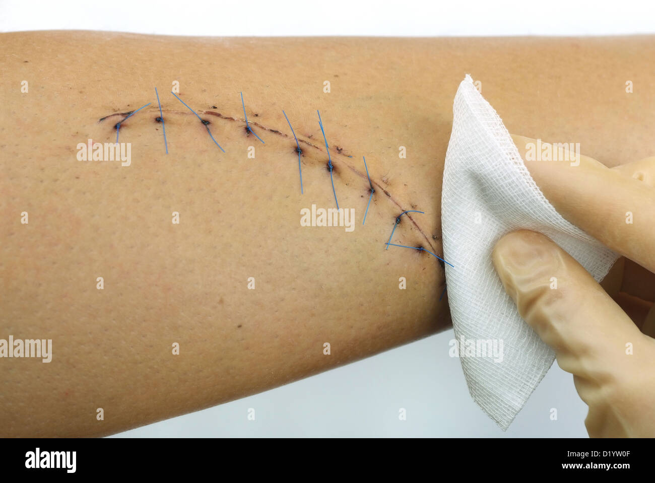 Stitched stitch stitches hi-res stock photography and images - Alamy