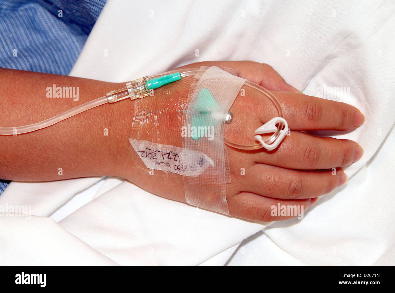 Hand with IV Stock Photo - Alamy