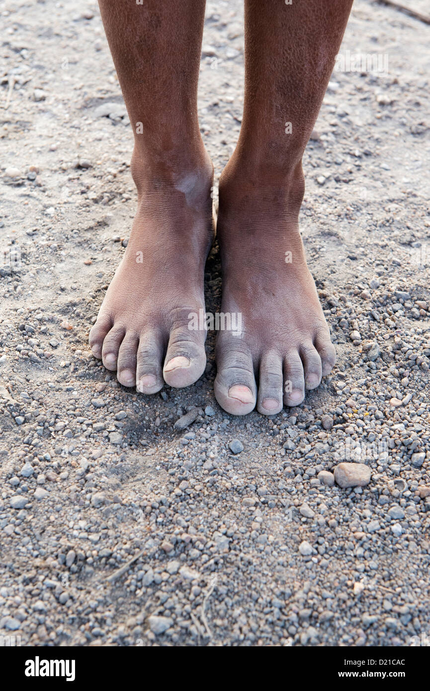 Bare Feet of young indian girl on a dusty track. Andhra pradesh, India ...