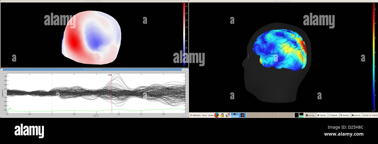 Magnetoencephalography hi-res stock photography and images - Alamy