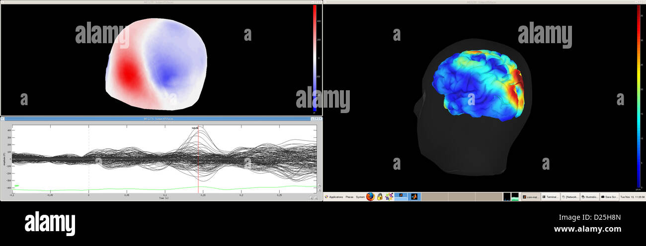Magnetoencephalography brain hi-res stock photography and images - Alamy