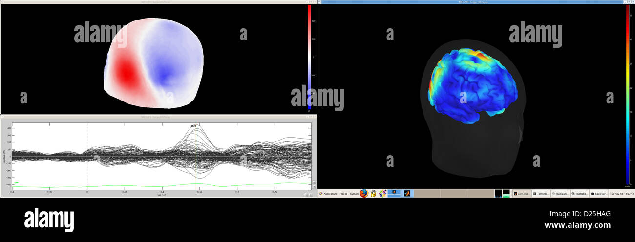 Magnetoencephalography brain hi-res stock photography and images - Alamy