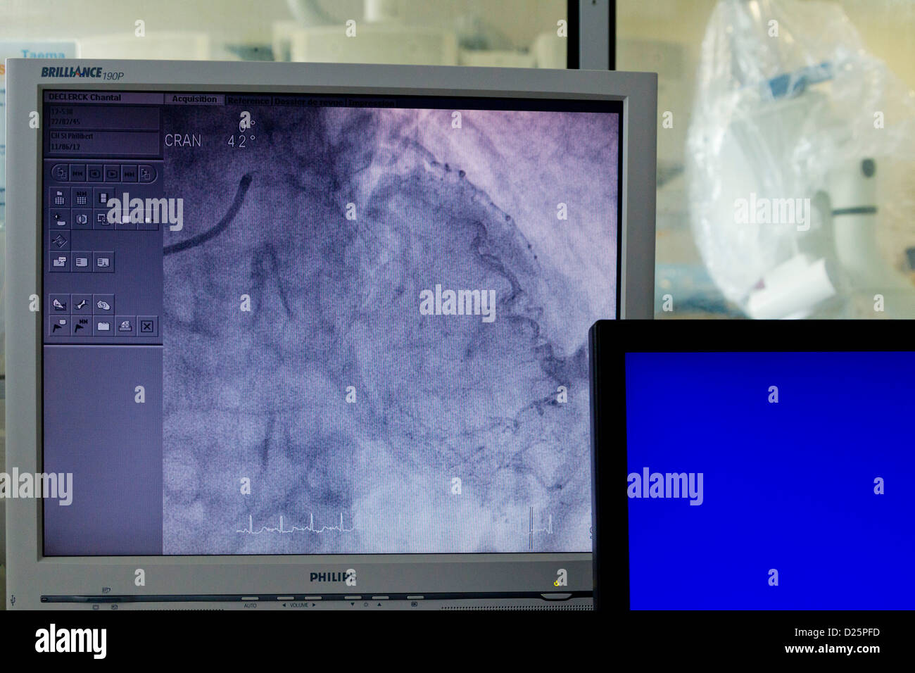 Coronary angiography ray examination hi-res stock photography and ...