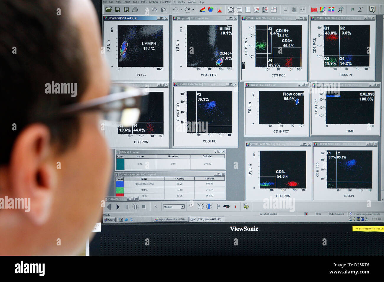 Flow cytometry test hi-res stock photography and images - Alamy