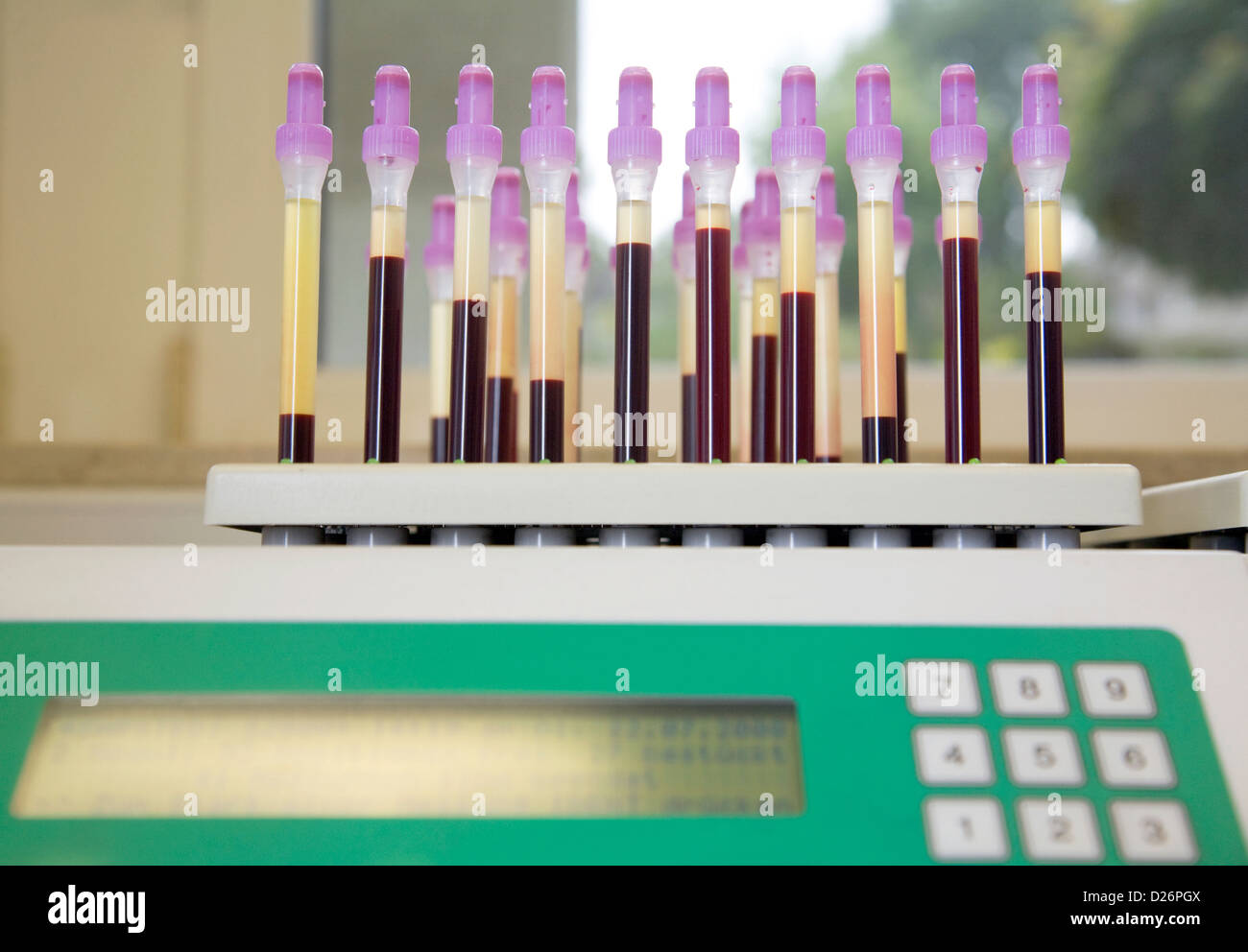 Essen, Germany, measurement of the erythrocyte sedimentation rate in a ...