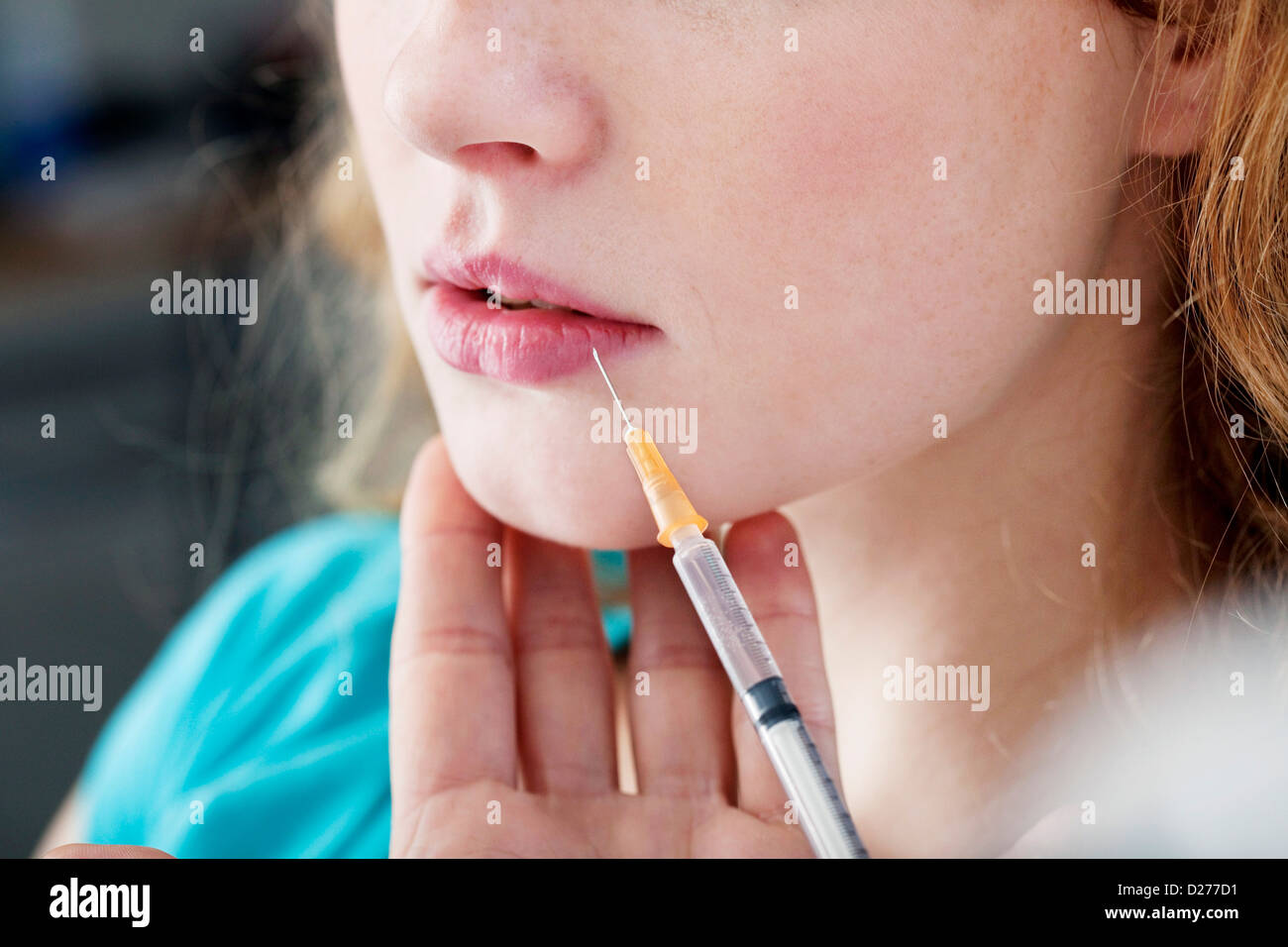 Labial surgery hi-res stock photography and images - Alamy