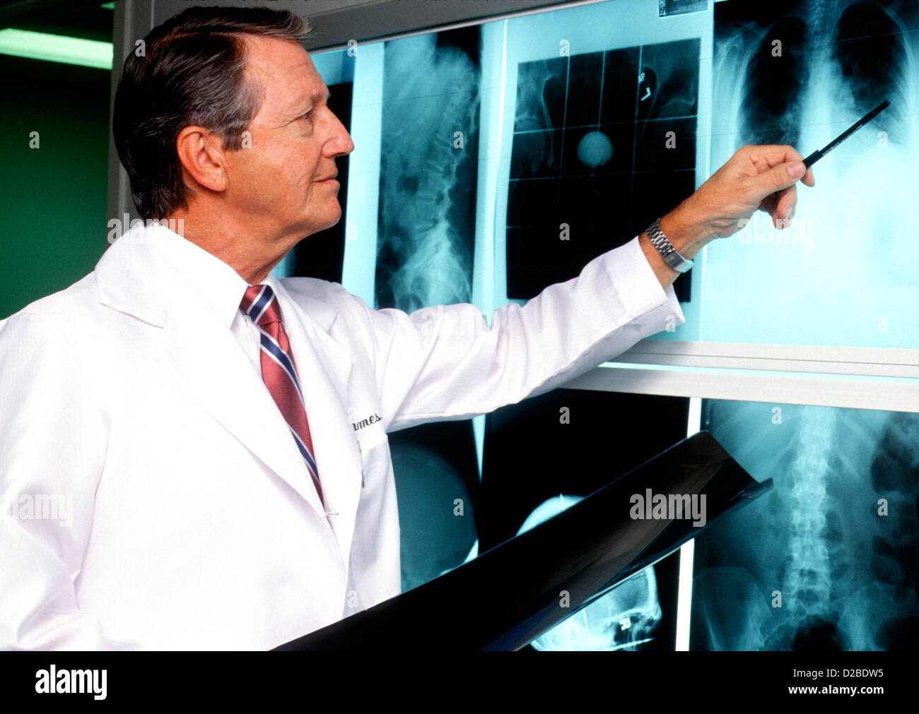 Doctor Examining X-Rays Stock Photo - Alamy