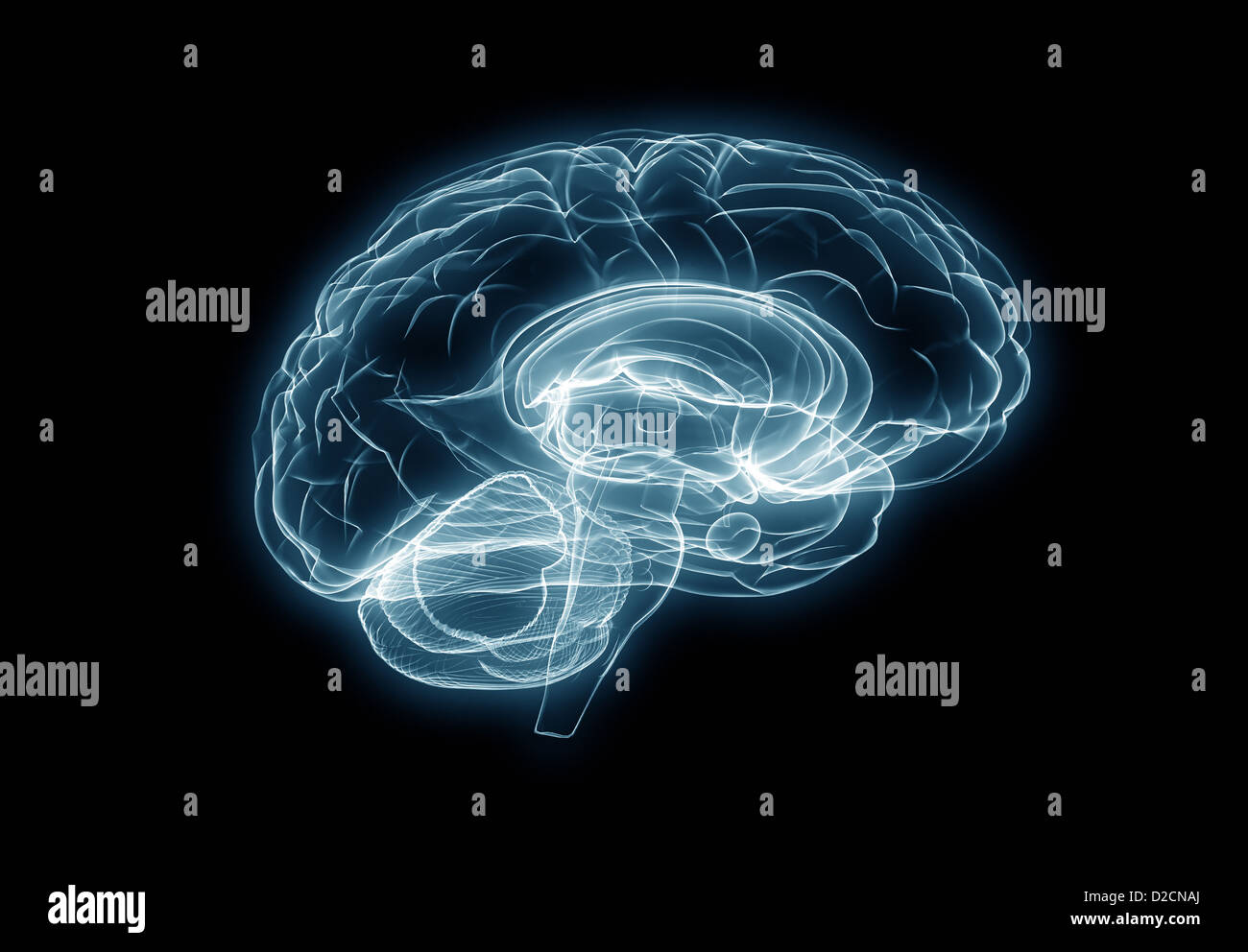 X-ray human brain Stock Photo - Alamy