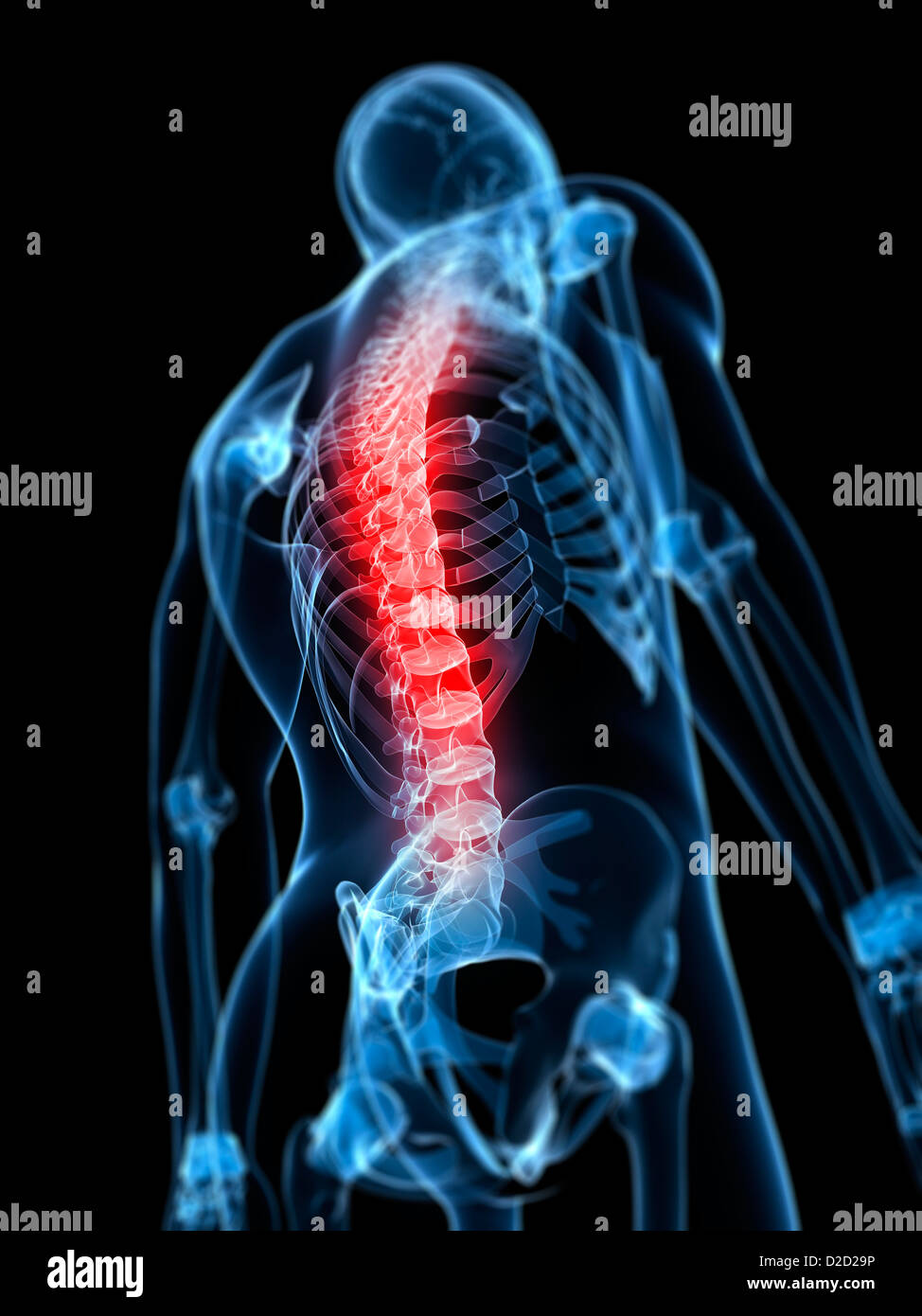 Science of pain illustration hi-res stock photography and images - Alamy