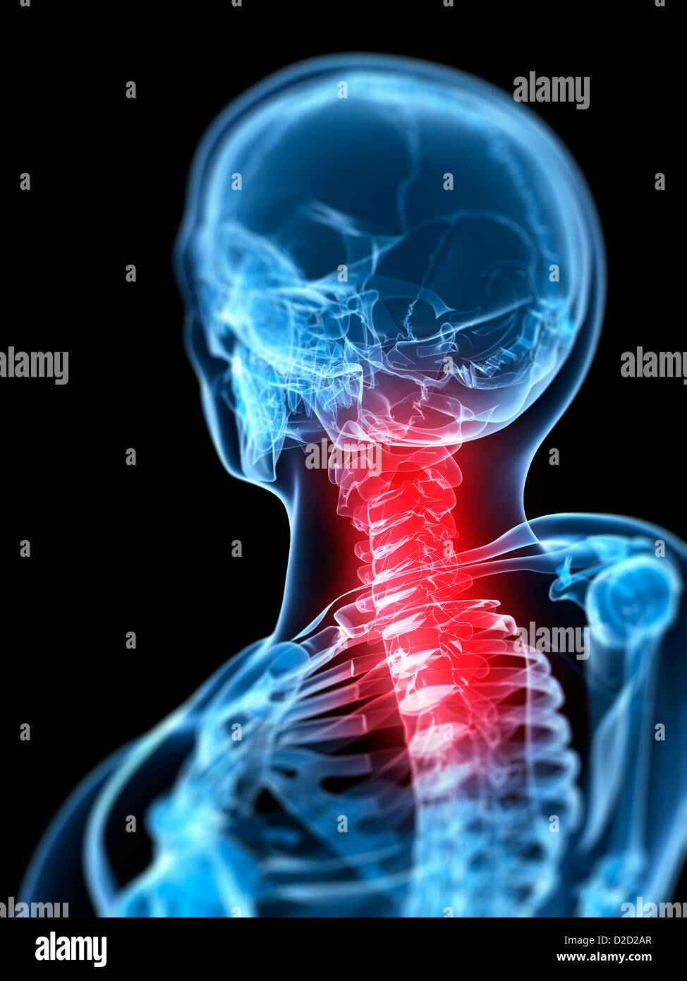 Human shoulder pain artwork hi-res stock photography and images - Alamy