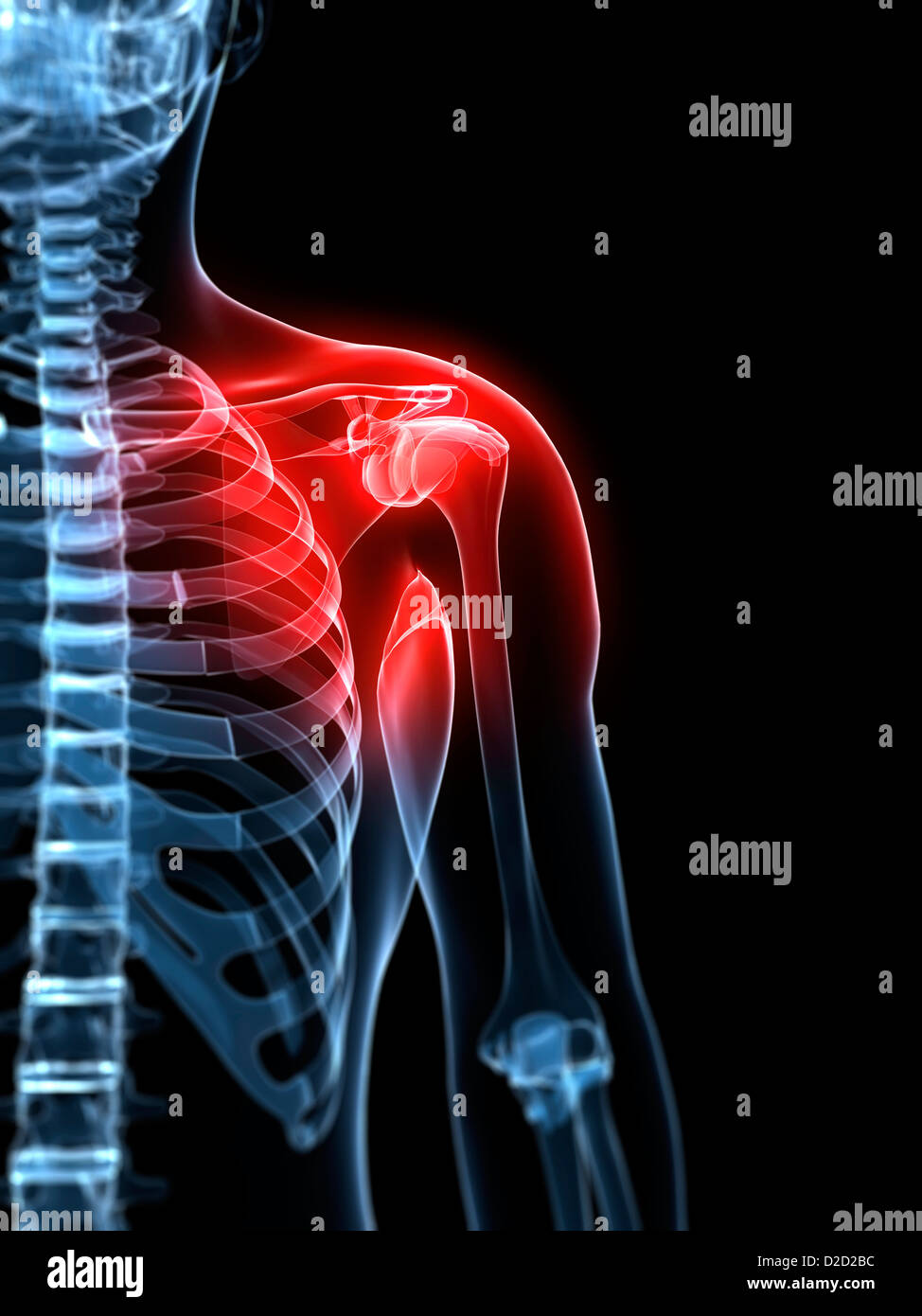 Shoulder pain conceptual computer artwork hi-res stock photography and ...